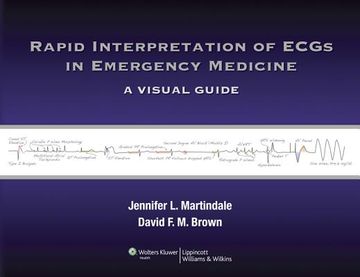 Libro Rapid Interpretation of Ecgs in Emergency Medicine: A Visual ...