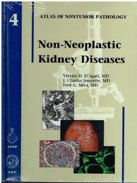 Libro Non-Neoplastic Kidney Diseases: Fascicle 4 (Atlas of Non-Tumor Pathology, Series 1,) De ...