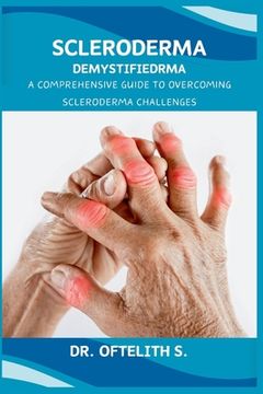 Libro Scleroderma Demystified: A Comprehensive Guide to Overcoming ...
