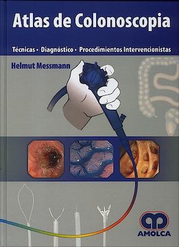Libro Atlas de Colonoscopia. Técnicas - Diagnóstico - Procedimientos ...